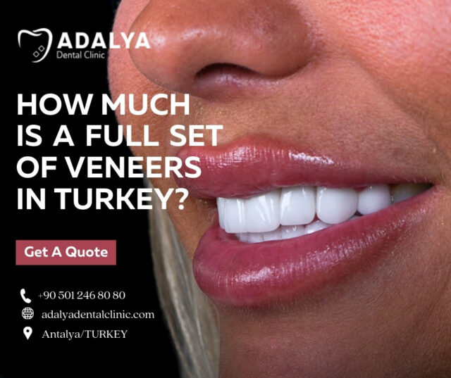 How Much Is A Full Set of Veneers in Turkey?