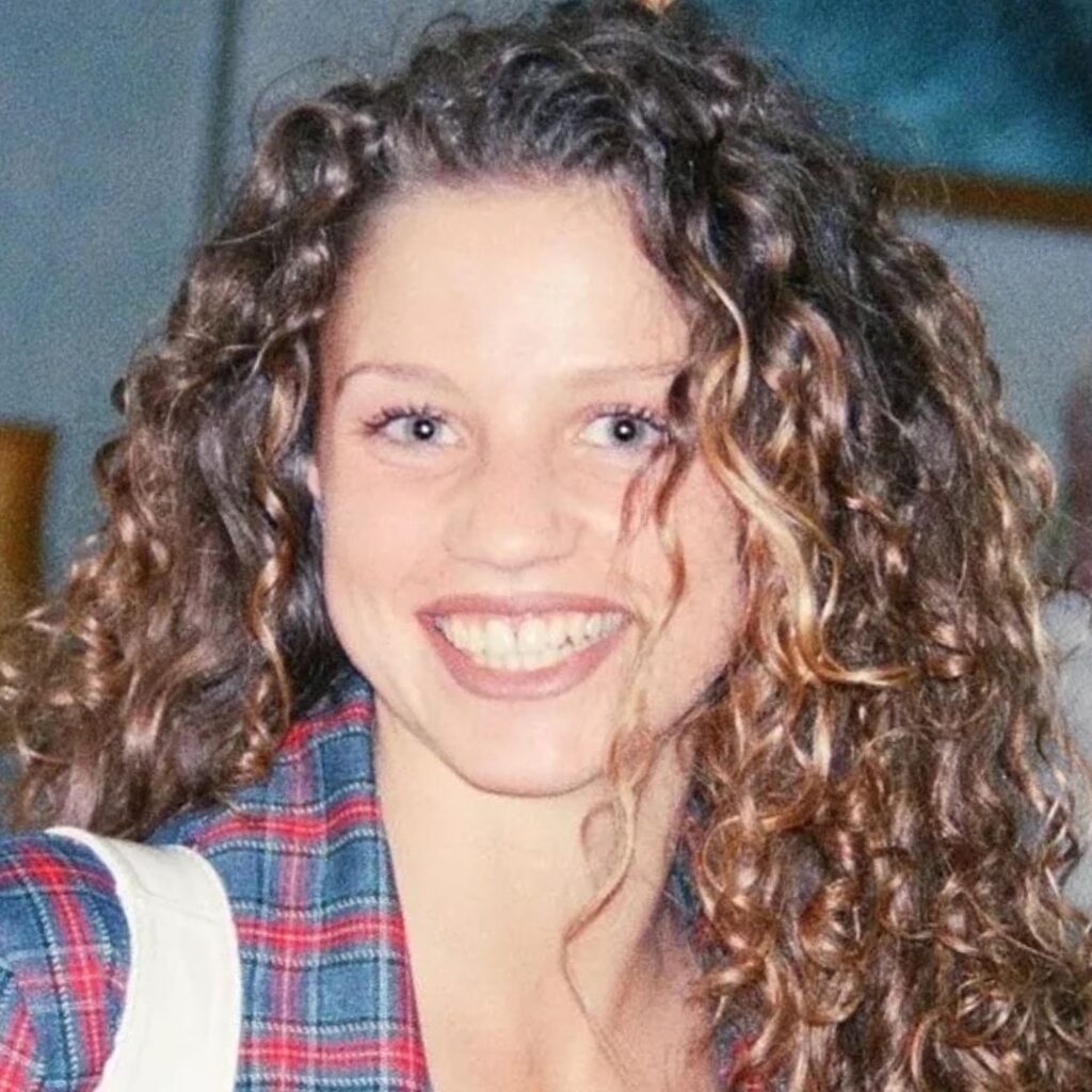 Katie Price Teeth: Before & After Veneers Journey | Adalya Clinic