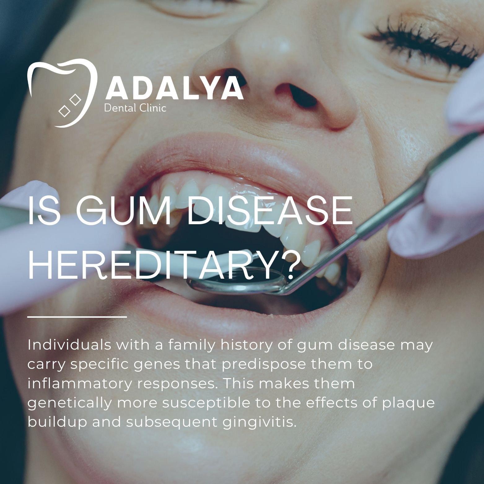 Is Gum Disease Genetic? - Hereditary Effect on Gums | Adalya