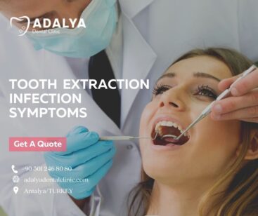 Tooth Extraction Infection Symptoms - Adalya Dental Clinic