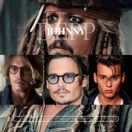 Johnny Depp Teeth: New, Rotting, Before & After Teeth Journey