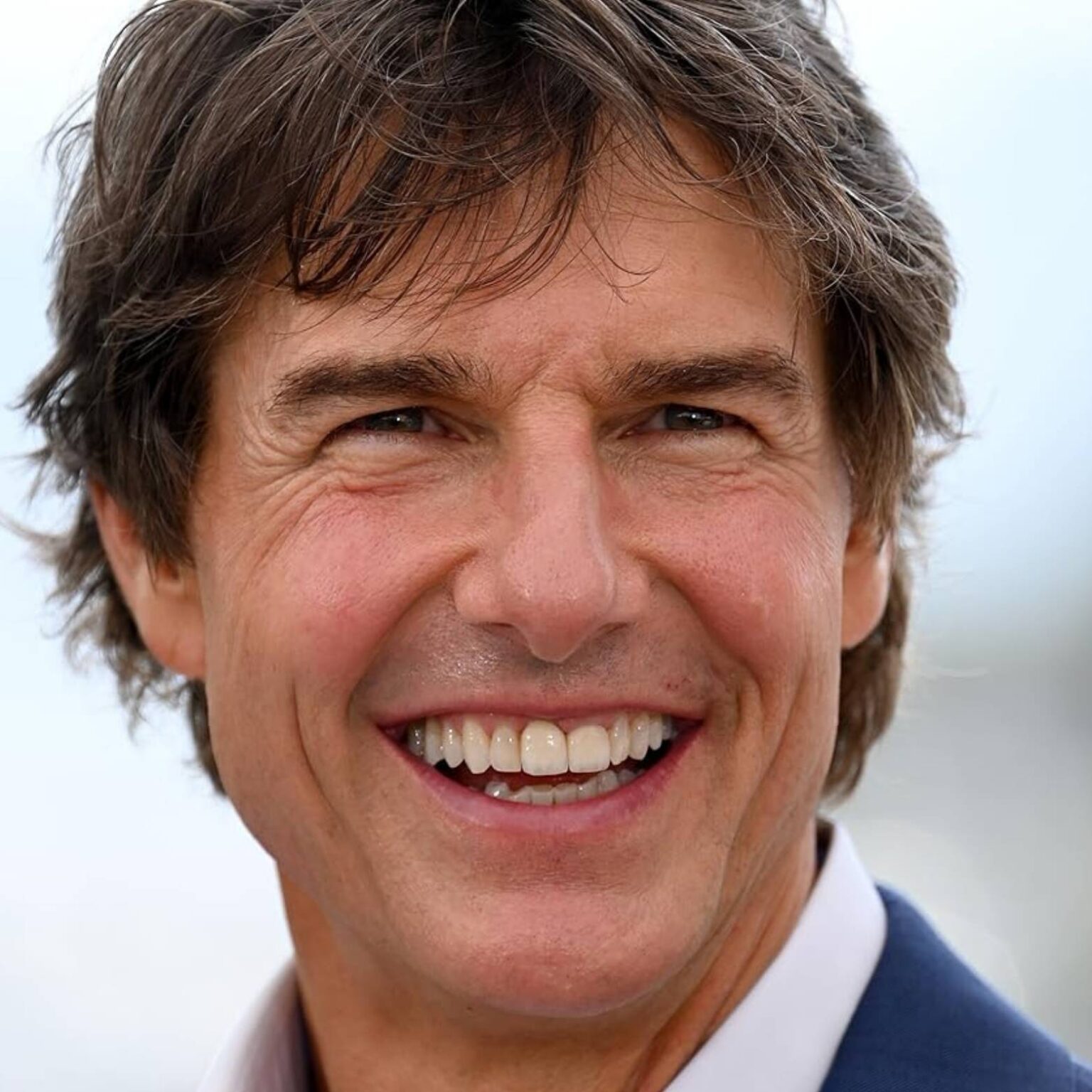 Tom Cruise Teeth: Before and After Journey, Teeth Line Problem