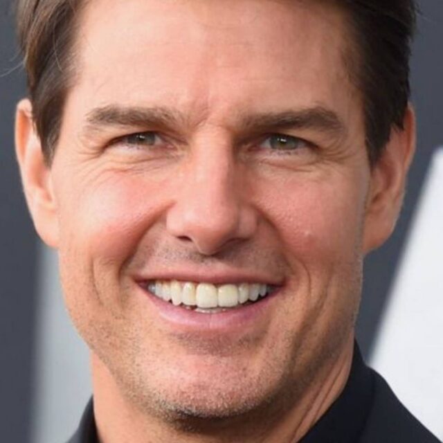 Tom Cruise Teeth: Before and After Journey, Teeth Line Problem