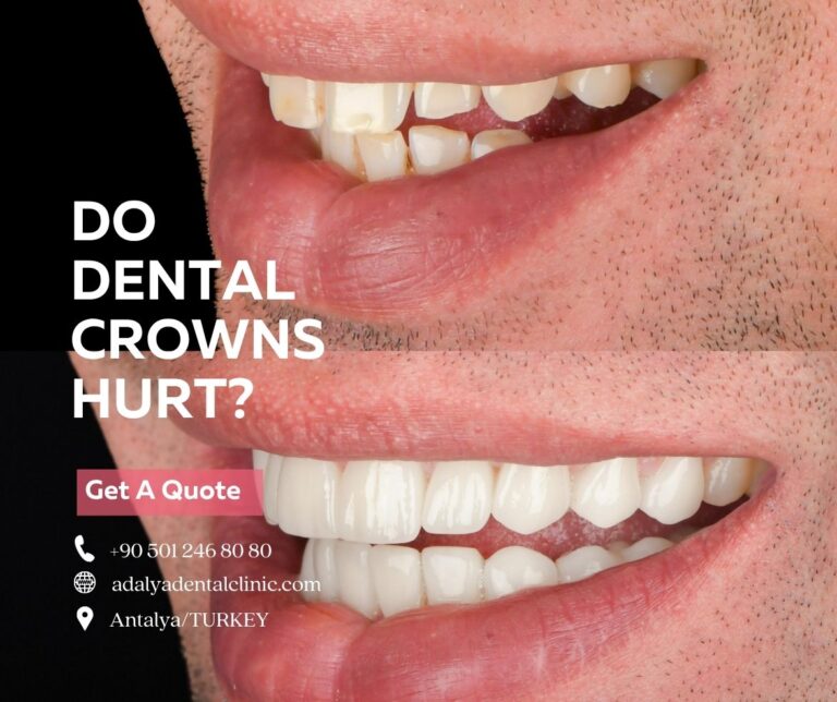 Do Dental Crowns Hurt? - Any Pain During Procedure & After