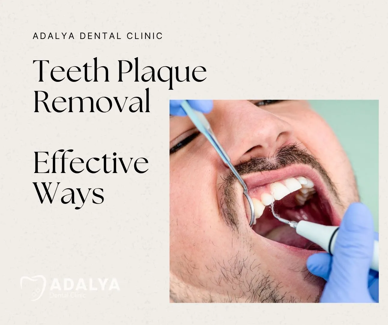 Teeth Plaque Removal: Effective Ways to Remove Dental Plaque